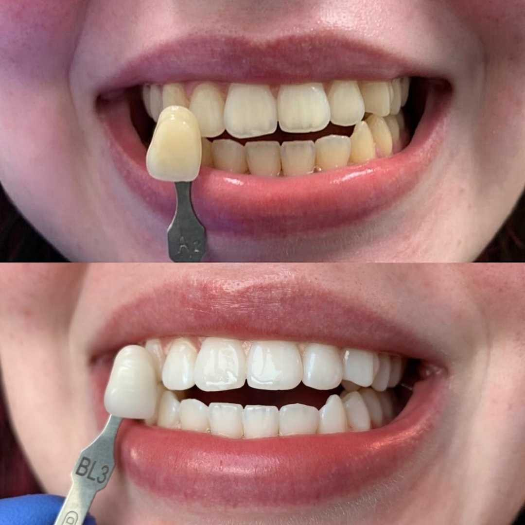 Smile Gallery | Dentistry On The Clyde